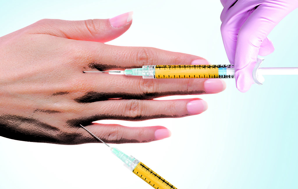 Autologous fat grafting | PRIME Journal