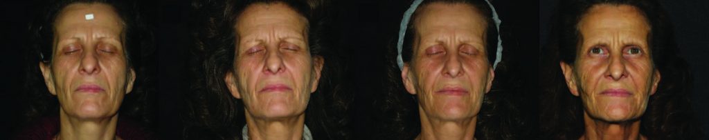 The Interstitial Fluid Technique and the Extracellular Matrix | PRIME ...