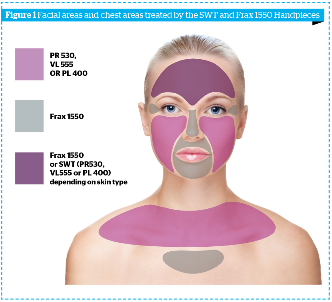 Light and Bright™ treatment of photodamaged skin and textural ...