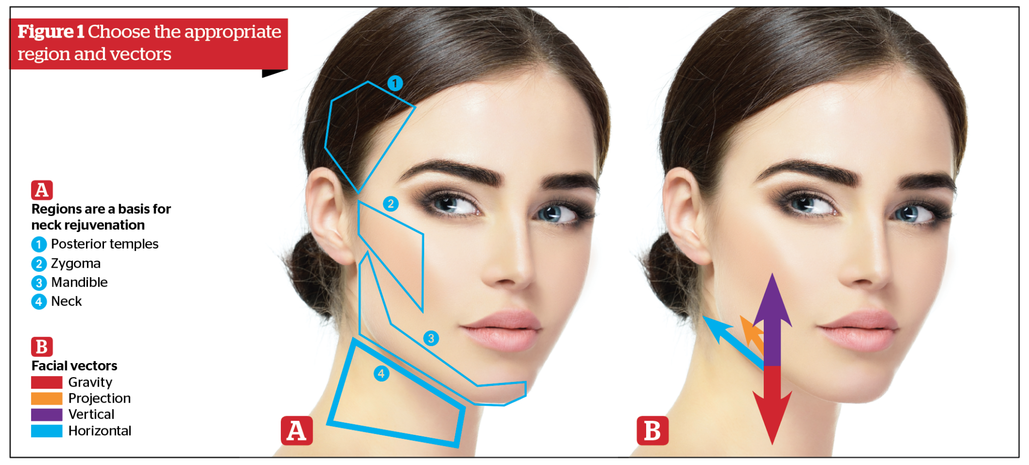 A systematic approach to neck rejuvenation | PRIME Journal