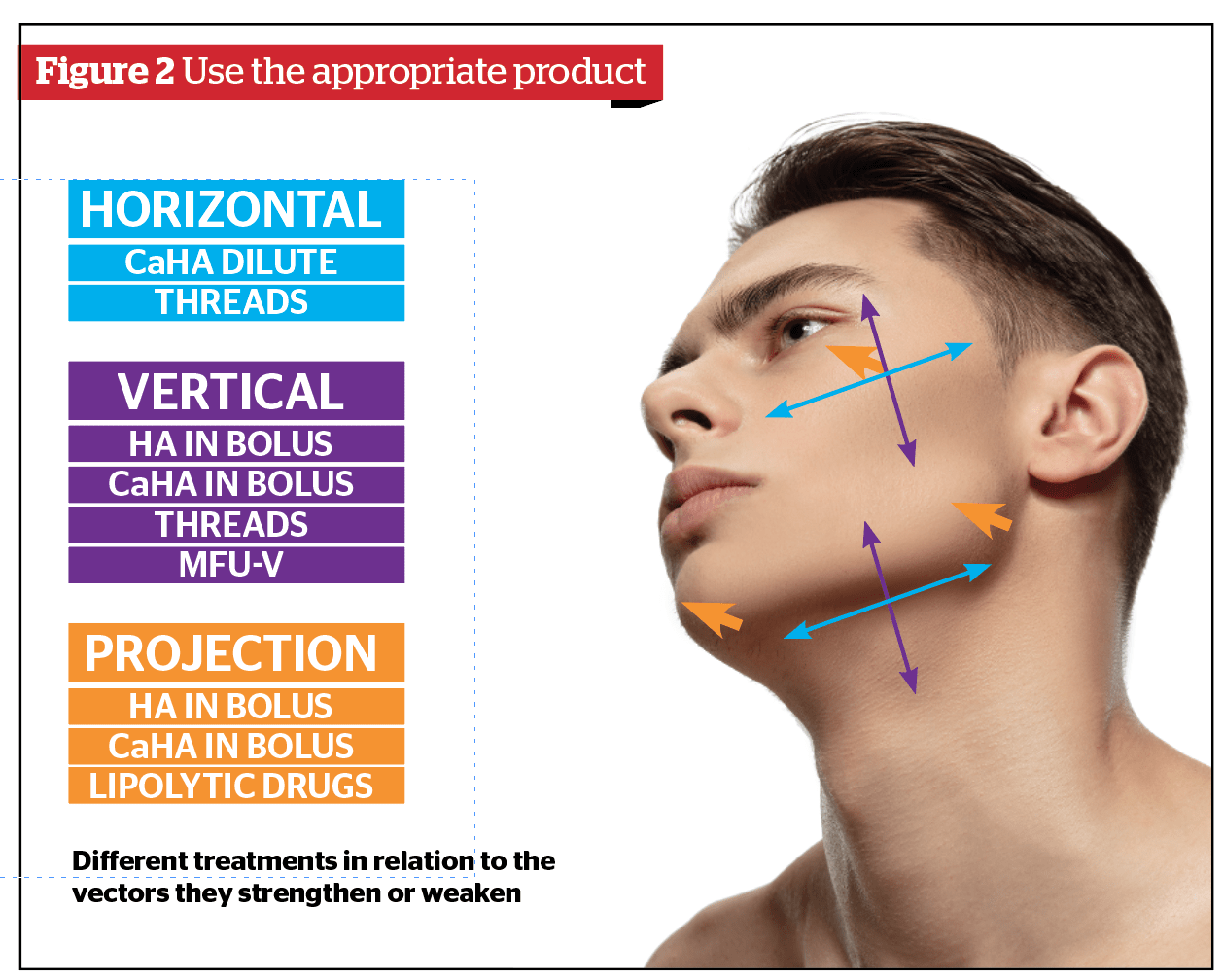 A systematic approach to neck rejuvenation | PRIME Journal