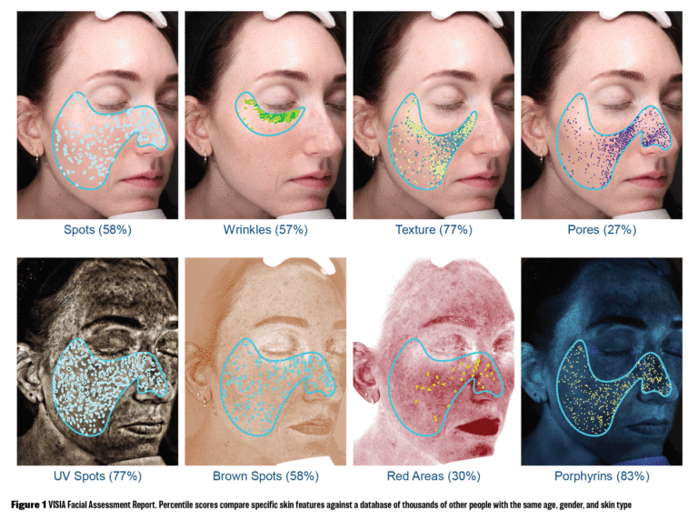 The Future of Beauty: The Rise of AI Skin Analysis in Aesthetics ...